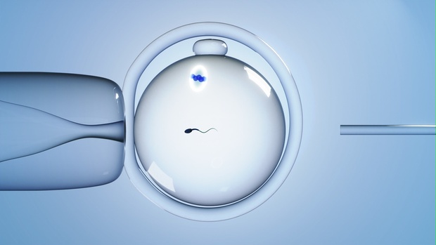 3D animation of Piezo-ICSI. Spindle is visualized. - omochiikko - BOOTH