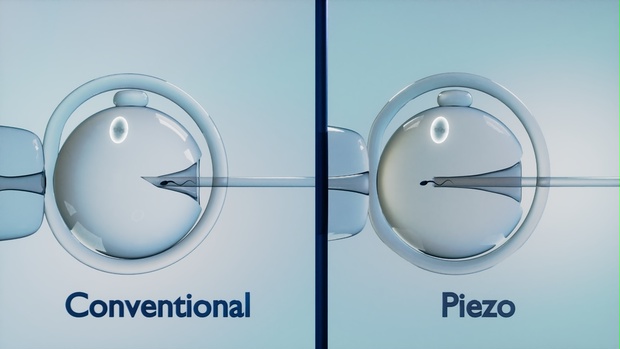 3D animation of conventional-ICSI vs piezo-ICSI. - omochiikko - BOOTH